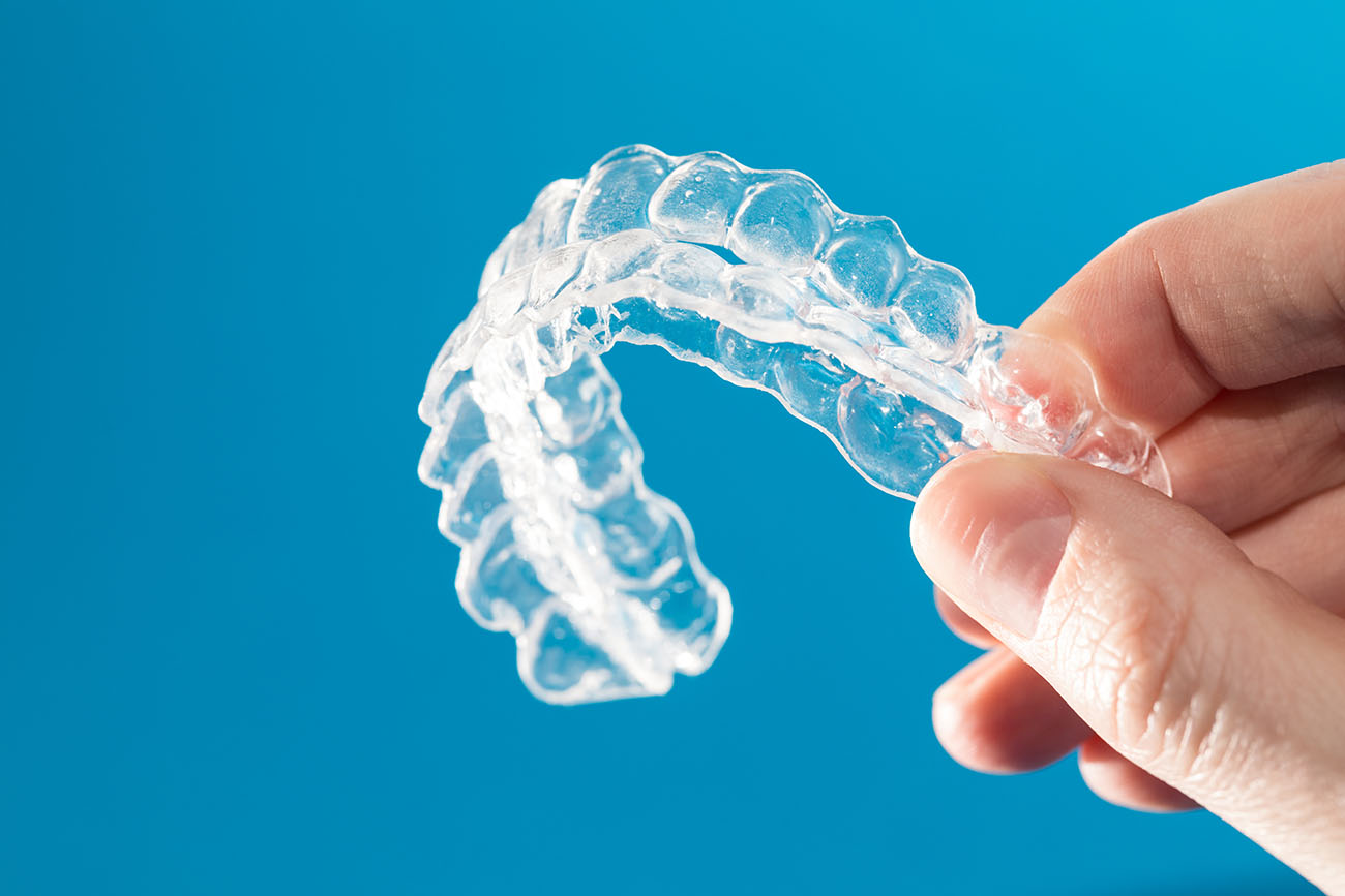 Eligibility Requirements for Invisalign | Dentist in Lititz, PA